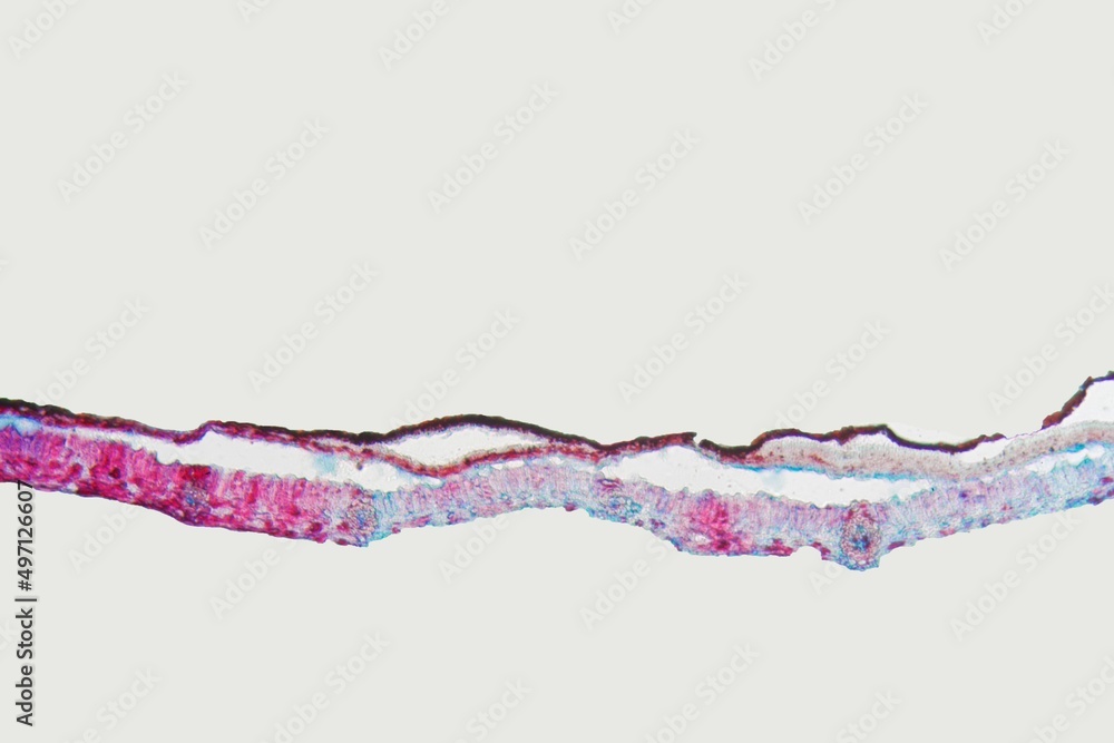 Rhytisma acerinum black spot disease on a maple leaf under the ...