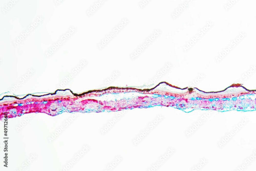 Rhytisma acerinum black spot disease on a maple leaf under the ...