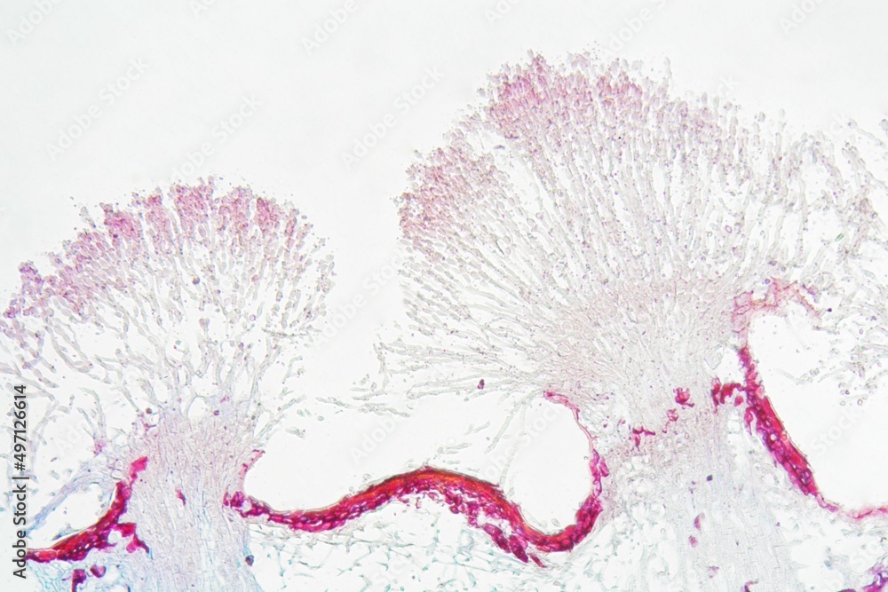 Monilinia fructigena under the microscope Stock Photo | Adobe Stock