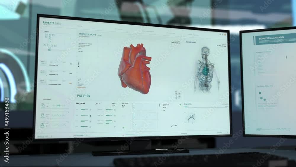 Scan Of Patients Body Discovers Dangerous Cardiac Ischemia Heart Organ ...