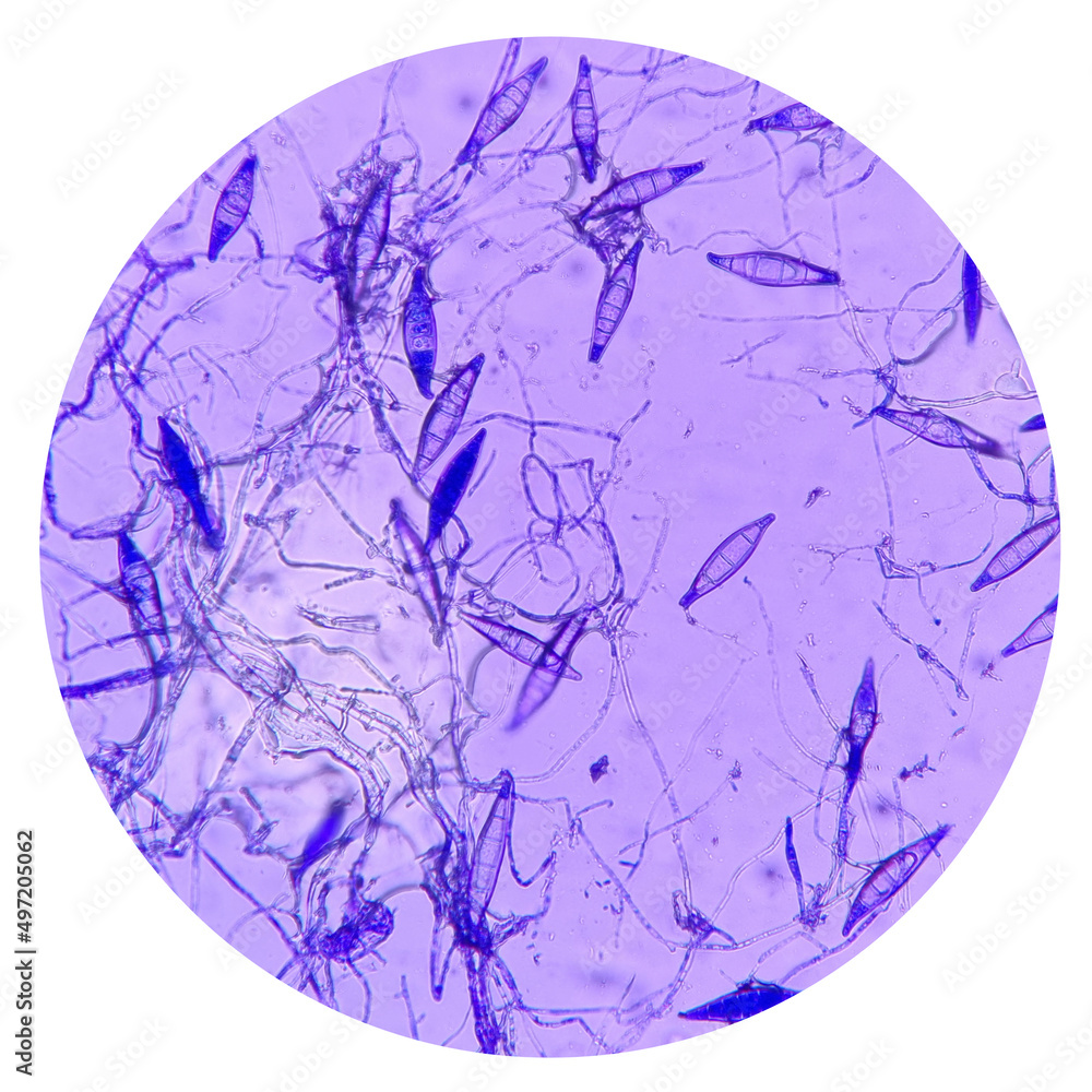 Microsporum Canis Dog