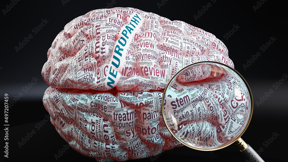 Neuropathy in human brain, a concept showing hundreds of crucial words ...