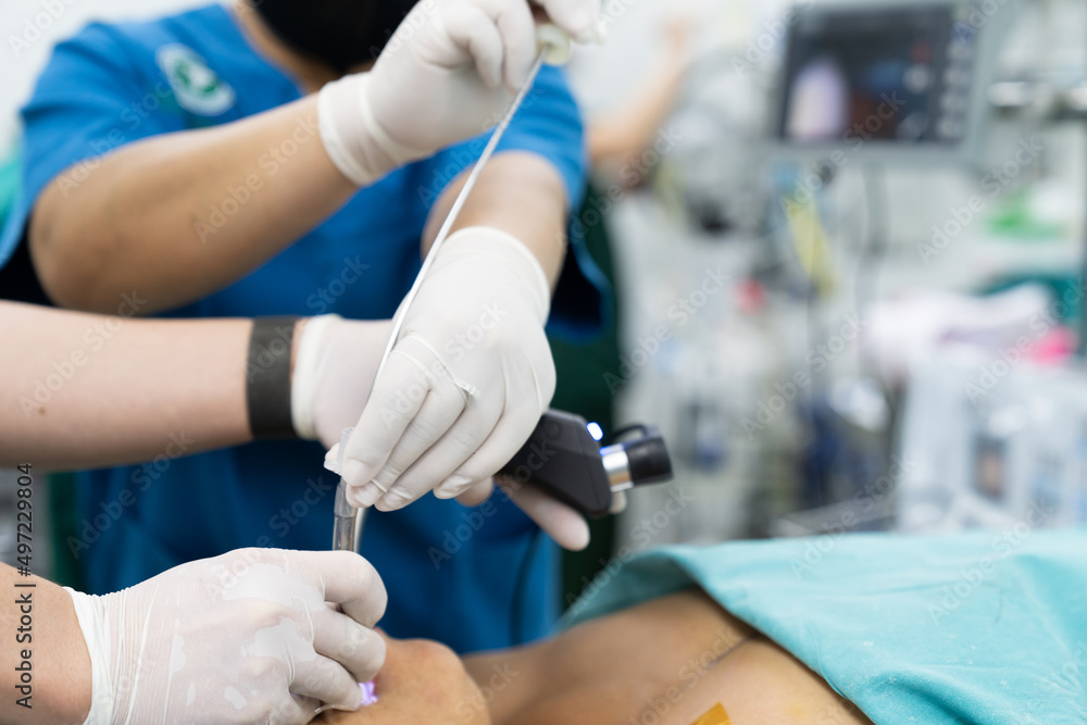 anesthesiologist use video laryngoscope for intubate endotracheal tube ...
