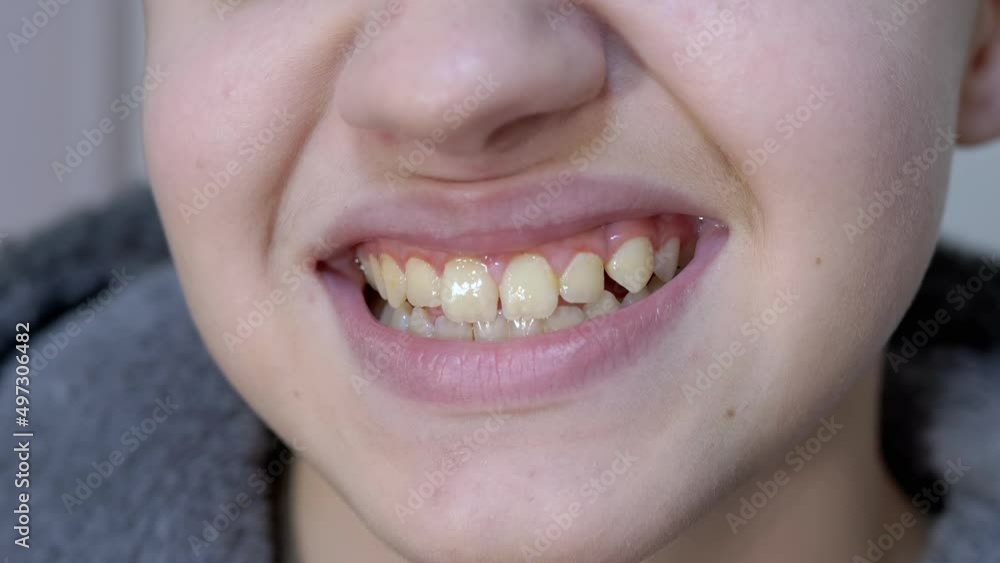 Vídeo do Stock: Wide Smile of a Happy Child with a Dirty Yellow Coating ...