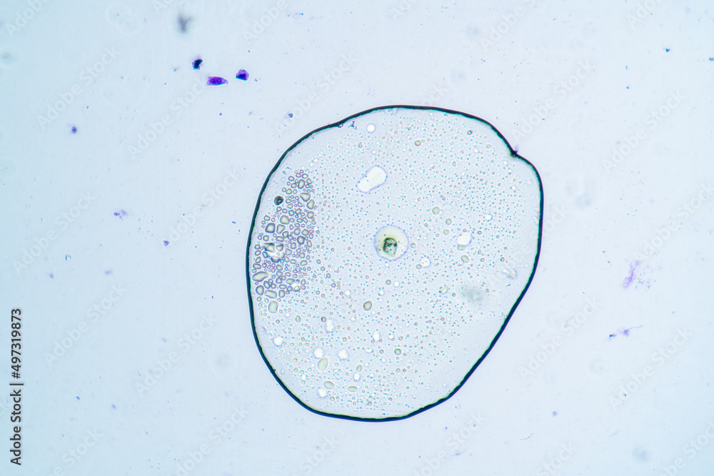 Biological fluid at a crime scene under a microscope as evidence of a ...