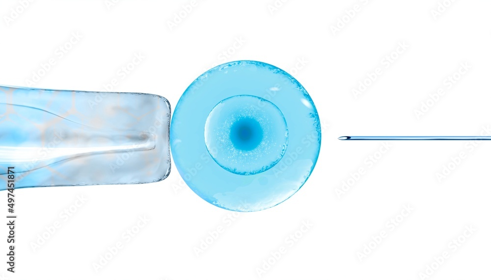 3d illustration of in vitro fertilization under a microscope. egg ...