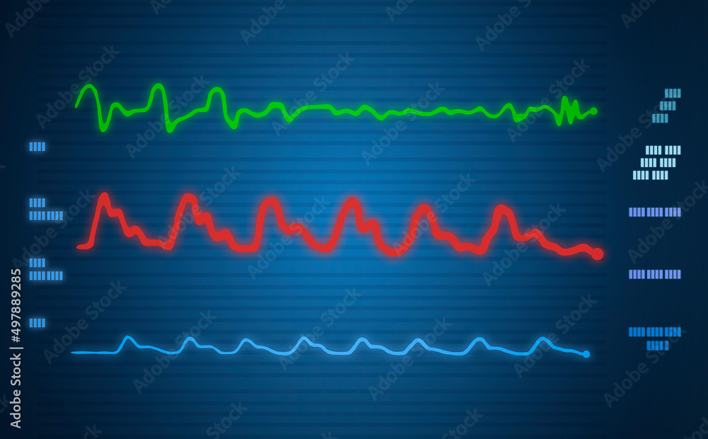 Patient monitor showing vital signs ECG and EKG. Stock Illustration ...