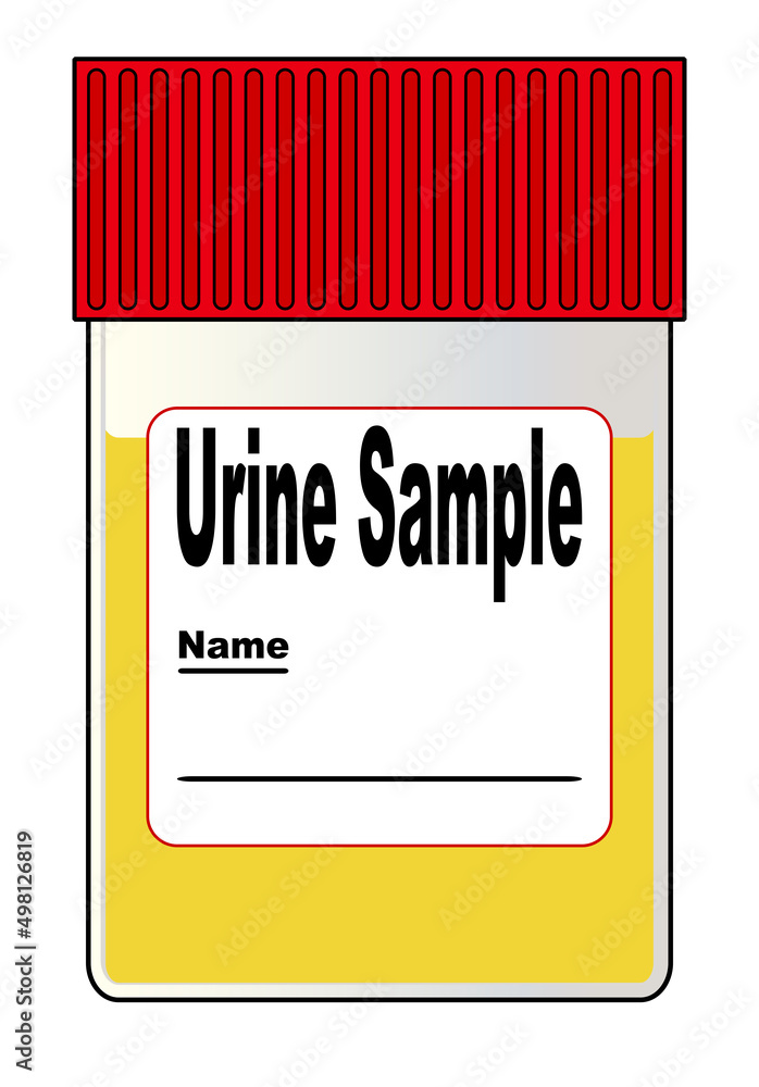 Urine Sample In Bottle Stock Vector | Adobe Stock