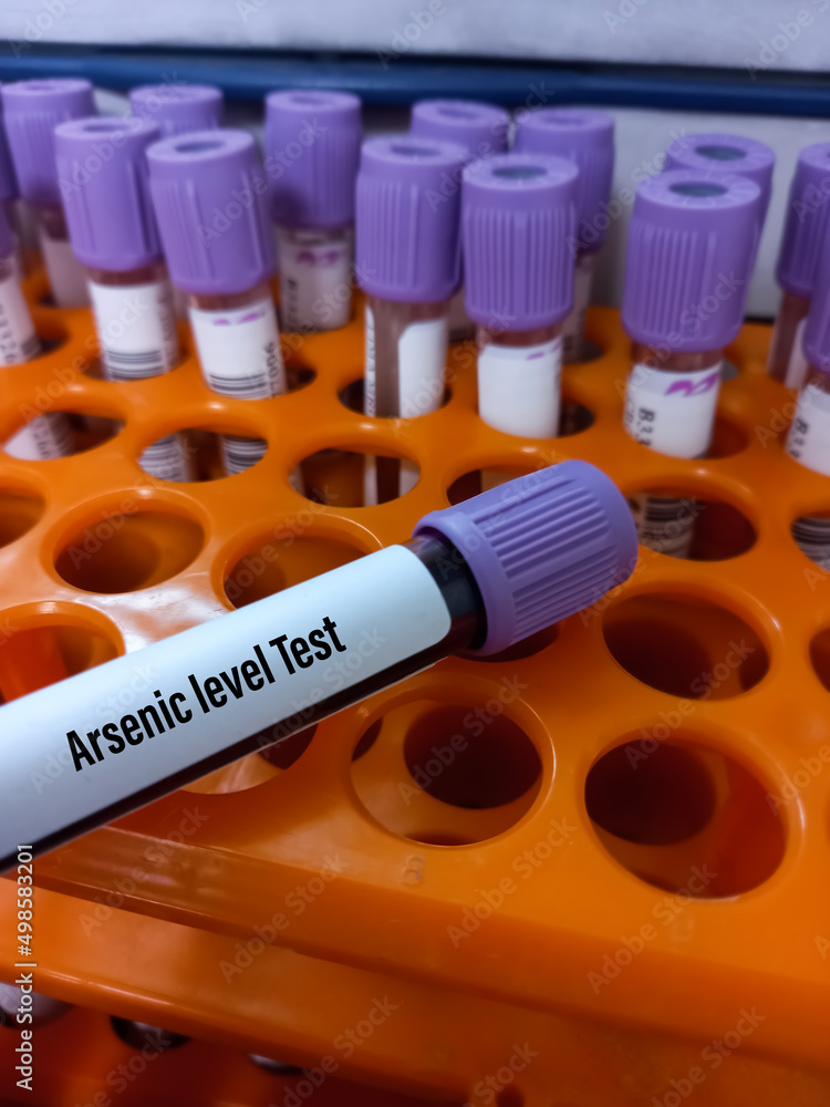 Blood sample for Arsenic panel test. Arsenic is a heavy metal element ...