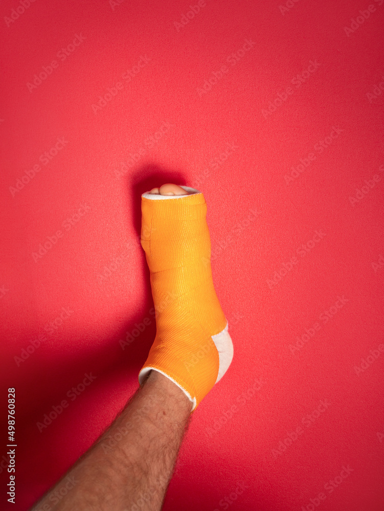 Foot with broken toe bone in orange fiberglass cast pink background ...