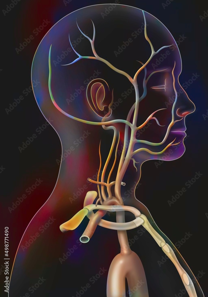 The arterial blood supply to the neck (carotids and vertebral. Stock ...