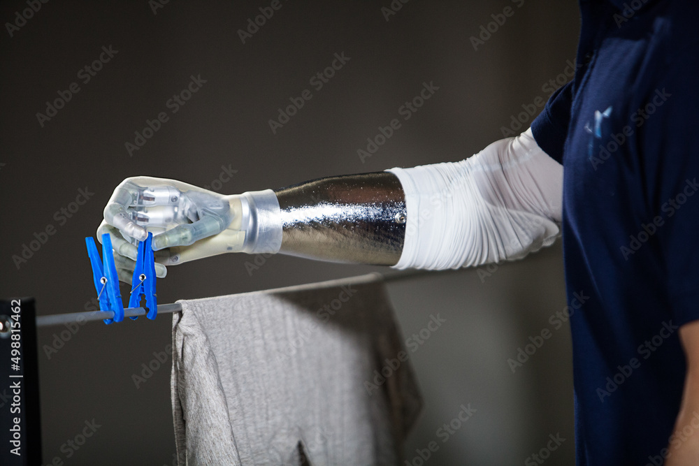 Person equipped with a robotic arm prosthesis. Stock Photo | Adobe Stock