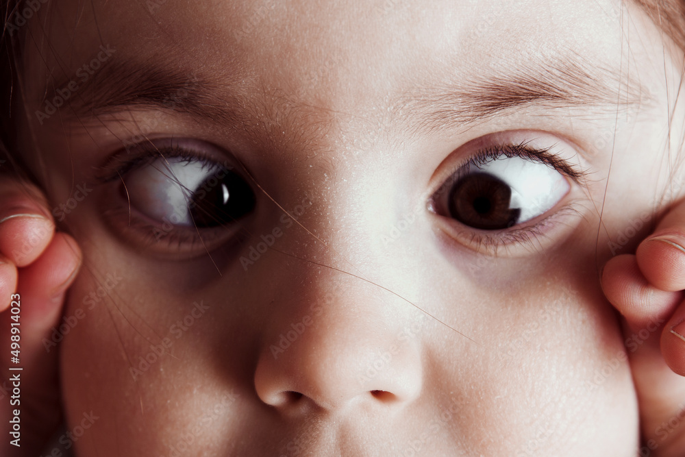 Eyes with squinted look and eyebrows on male face. Female eyes with ...