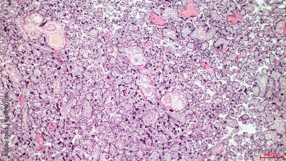 Human placenta with chorionic villi, blood vessels and red blood cells ...