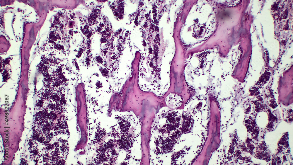 Human red bone marrow, hematopoietic press. The big tsit beetveen ...