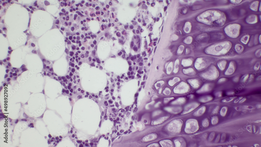 Cartilage and bone: Epiphyseal plate. Human red bone marosh ...