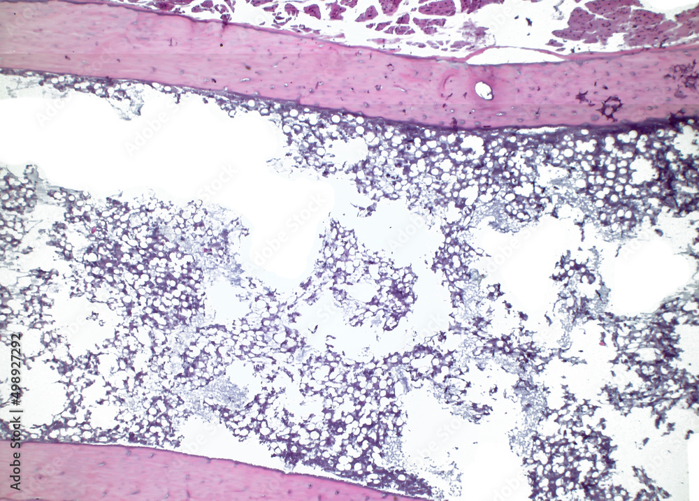 Longitudinal section of the tubular bone of the rat. Compact bone forms ...
