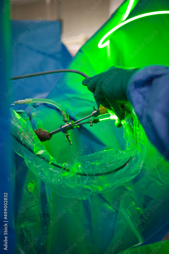 Laser surgery for the treatment of benign prostatic hyperplasia. Stock ...