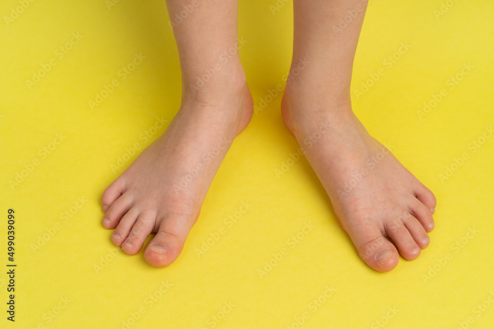 children's feet on a yellow background front view, the concept of ...