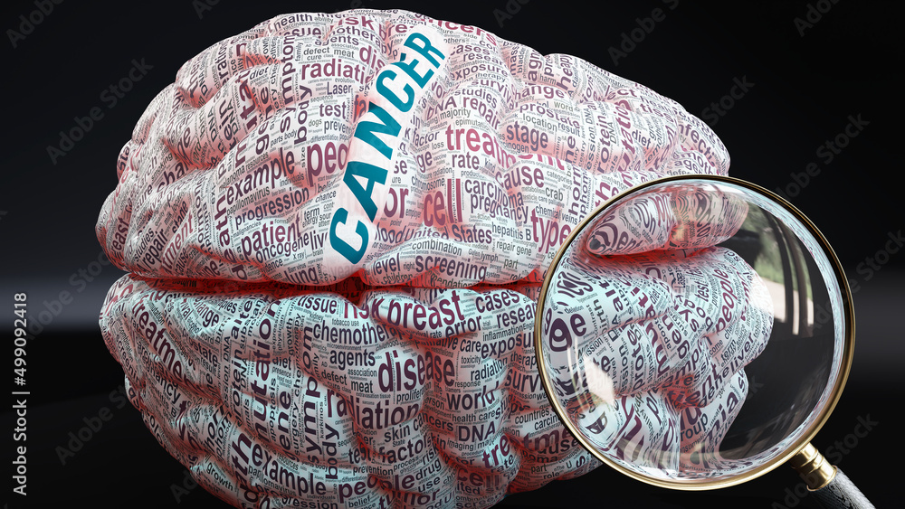Cancer in human brain, a concept showing hundreds of crucial words ...