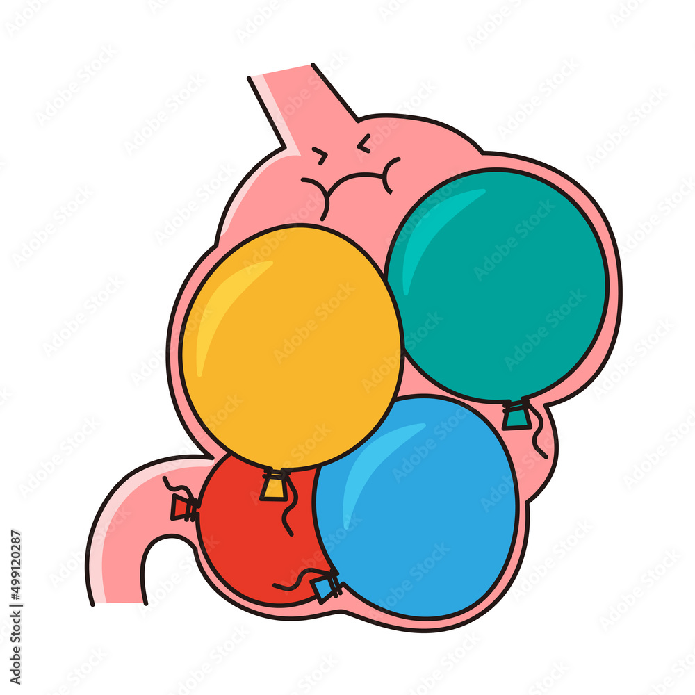 Vector illustration of a bloating stomach. Stock Vector | Adobe Stock