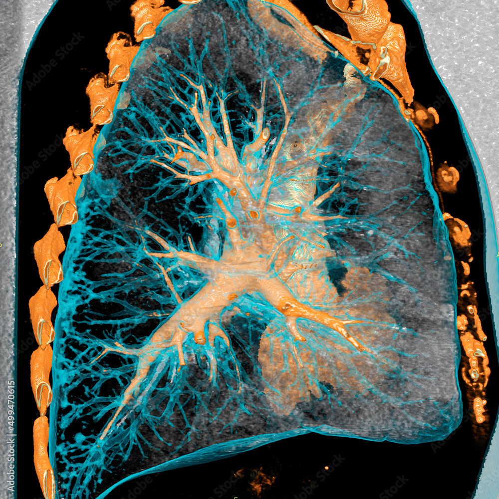3D scanner of thoracic anatomy. Stock Illustration | Adobe Stock