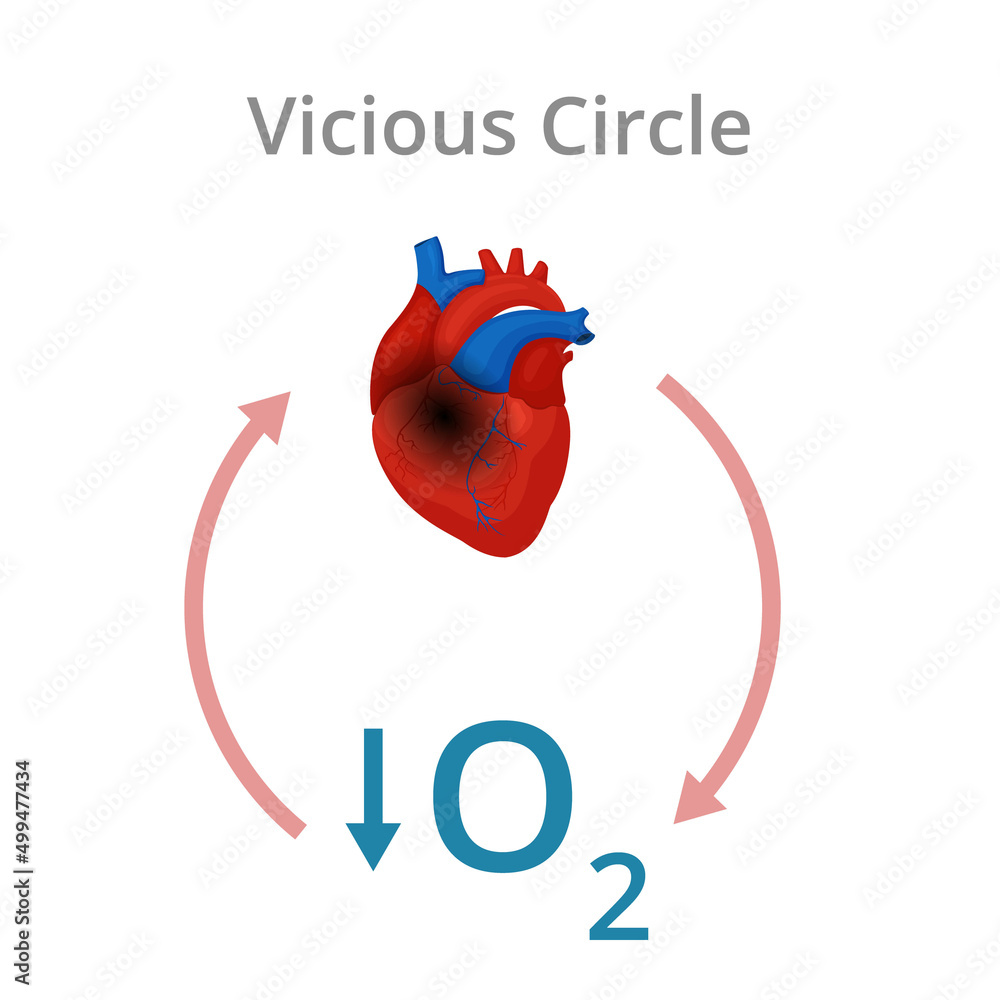 Vicious circle simplified vector diagram. Stock Vector | Adobe Stock