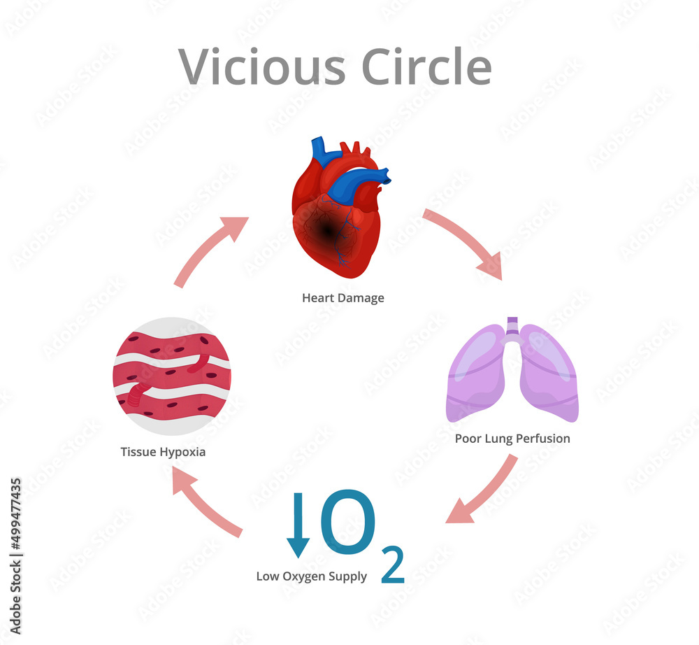 Vicious circle diagram. Conceptual illustration of the heart damage ...