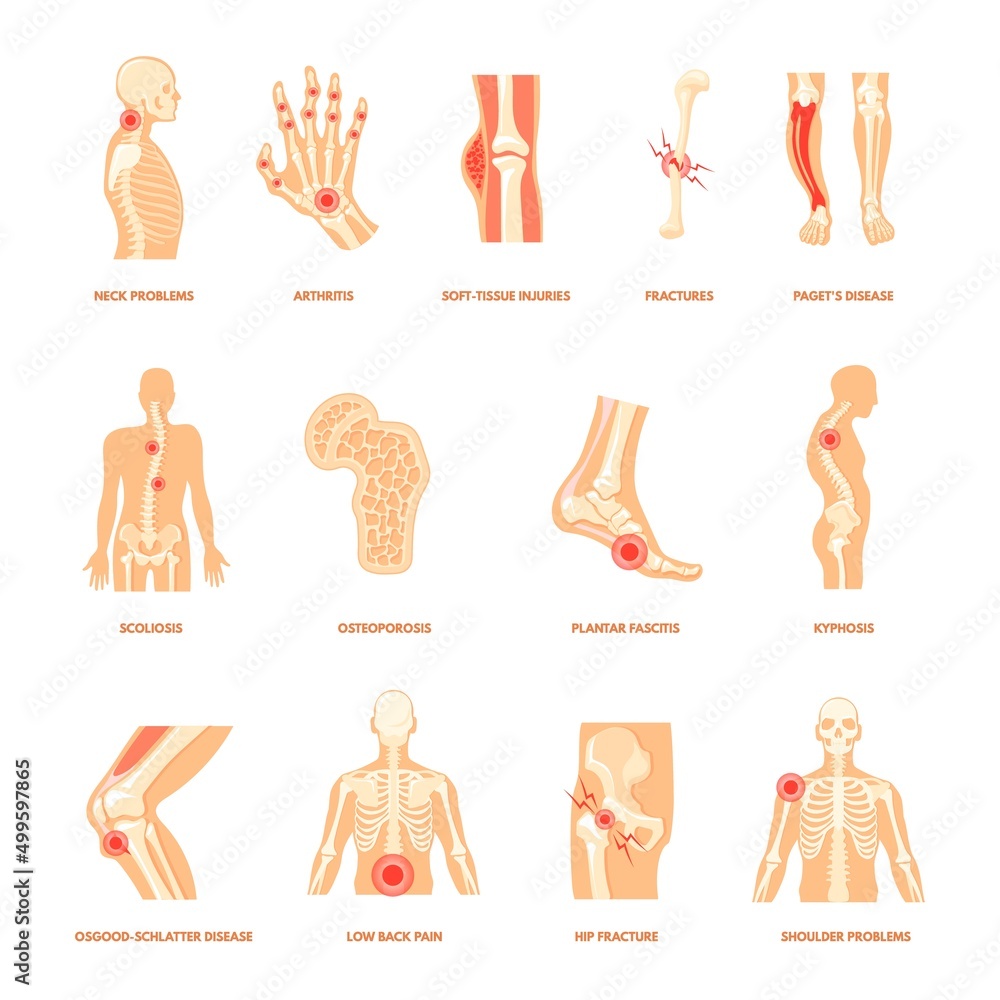 Body orthopedic problem. Human bone injury, anatomy health diseases ...