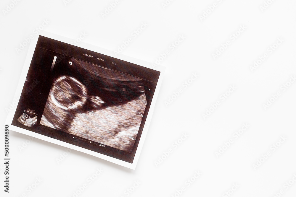 Pregnancy background with ultrasound picture of unborn baby Stock Photo ...