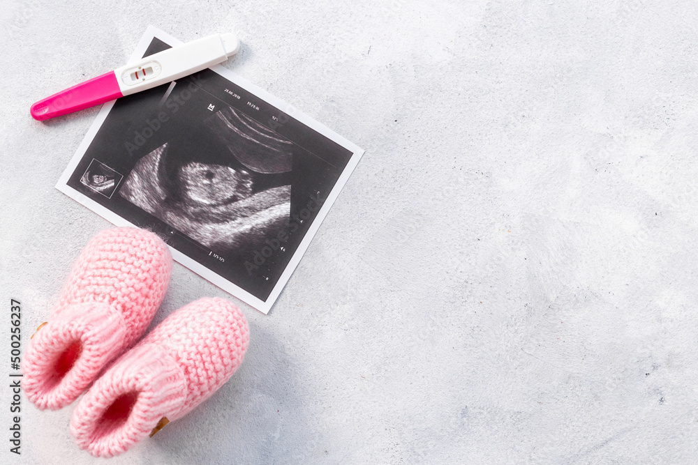 Ultrasound picture of unborn baby - pregnancy concept Stock Photo ...