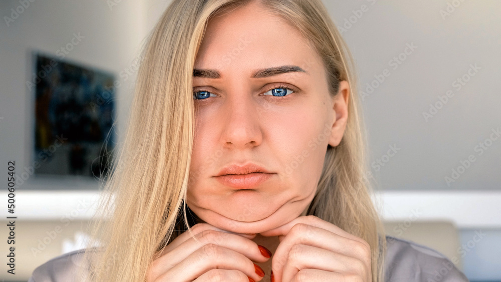 Second chin, obesity. A portrait of a 30-year-old woman pulling back ...