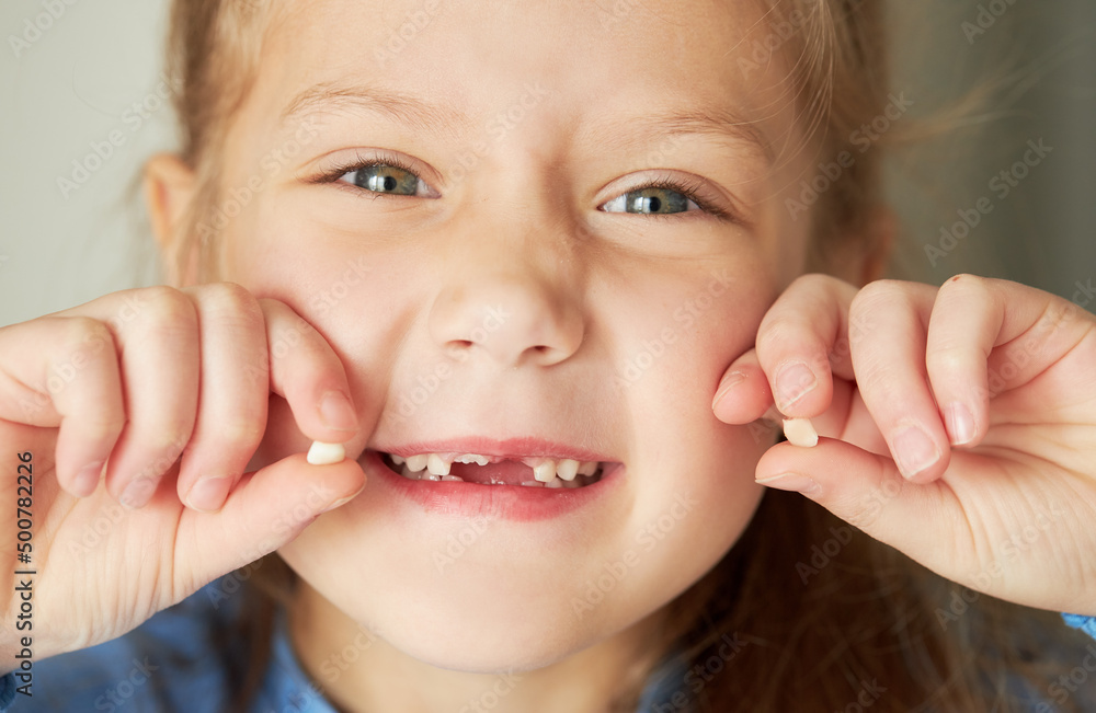 Toothless child. Cute little girl smiles broadly. The first milk tooth ...