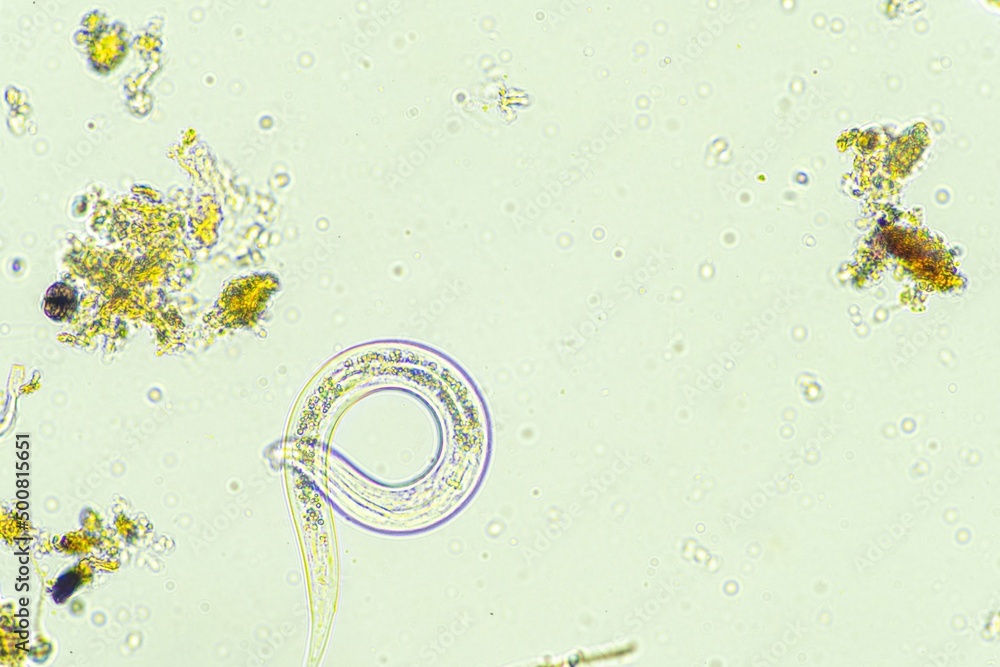 biological organisms under the microscopes in australia. living ... biological organisms under the microscopes in australia. living ...