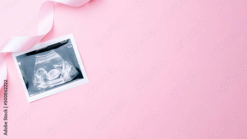 Ultrasound image pregnant baby photo. Fashion cute baby cloth with ...