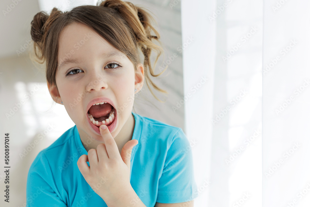 The kid lost a tooth. Baby without a tooth. Portrait of a little girl ...