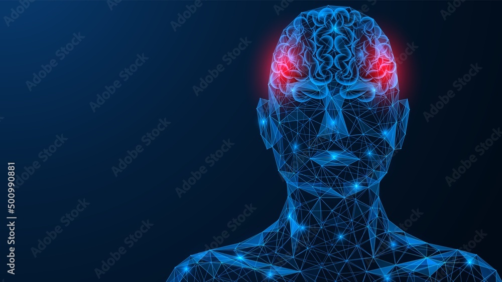 Pulse headache. Pain in the temporal region of the head. Polygonal ...