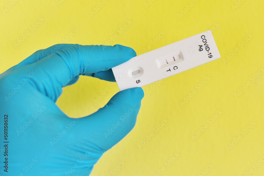 COVID-19 positive test result by using COVID-19 antigen test kit or ATK ...