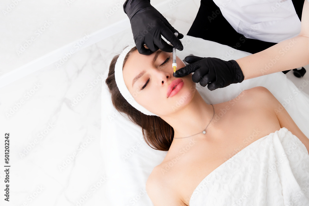 Lip contouring. Lip augmentation with hyaluronic acid. Top view. Stock ...