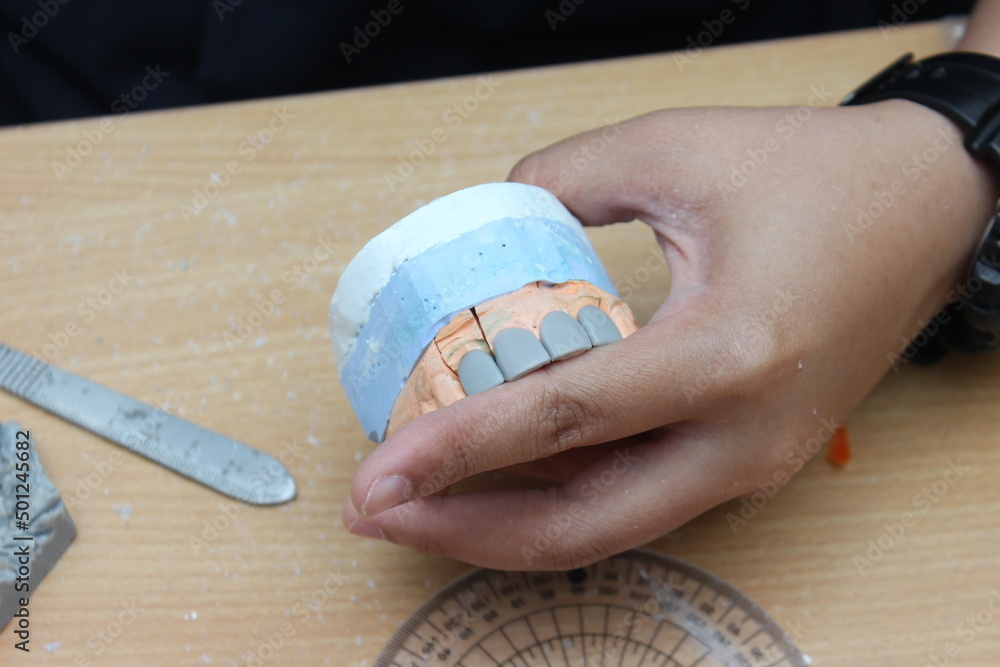 It is a procedure for making a dental model. before submitting the work ...