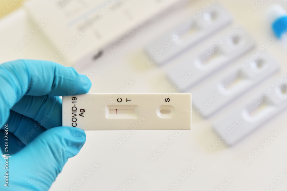 COVID-19 negative test result by using COVID-19 antigen test kit or ATK ...