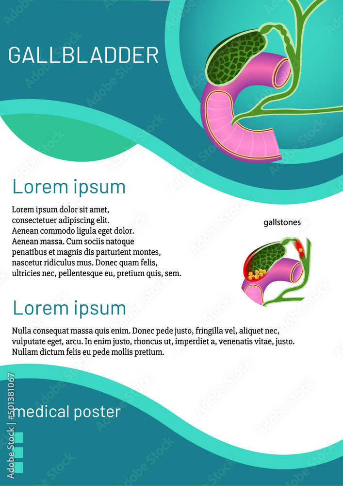Brochure template with gallbladder. Medical poster for printing. Vector ...