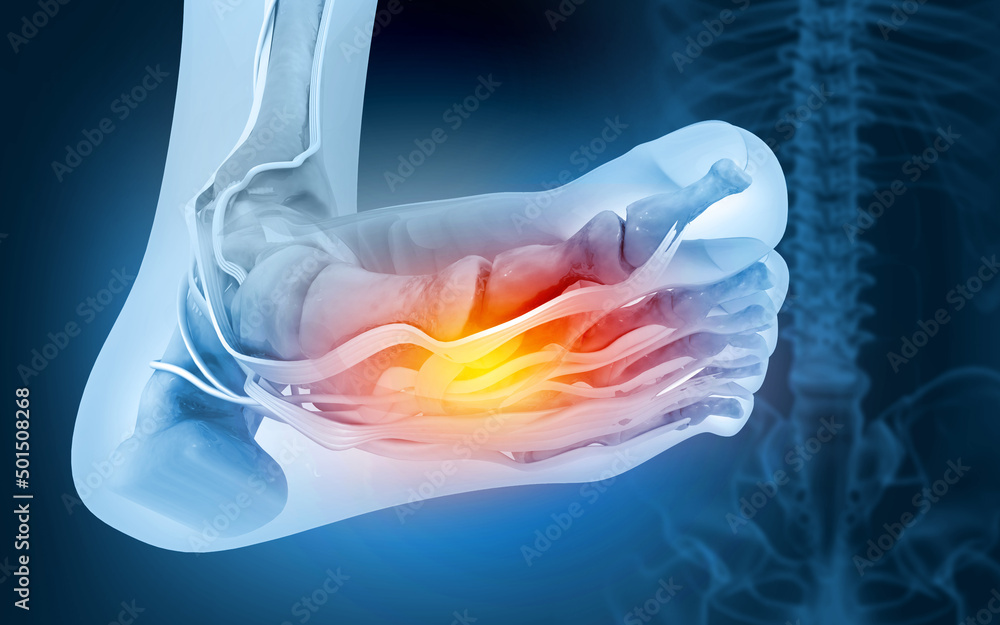 Foot pain anatomy. 3d illustration Stock Illustration | Adobe Stock