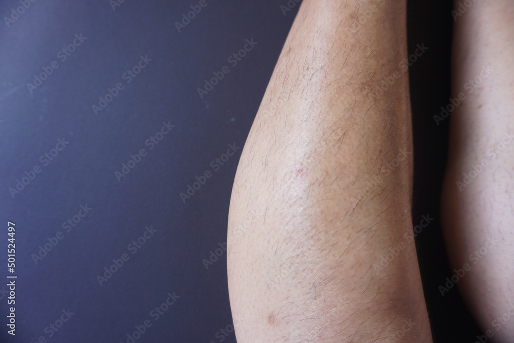 Woman's leg with messy shin hair on black background. Leg hair is the ...