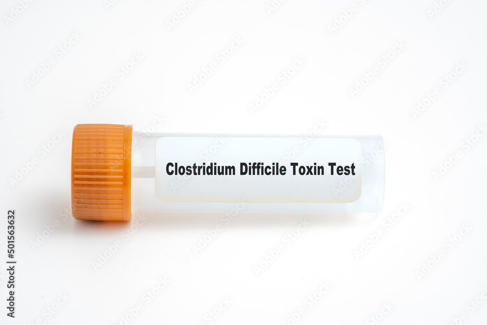 Clostridium Difficile Toxin Test ภาพถ่ายสต็อก | Adobe Stock