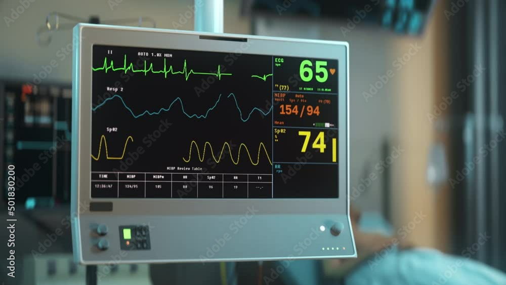 Electronic pulse monitoring system is checking the vital signs of the ...