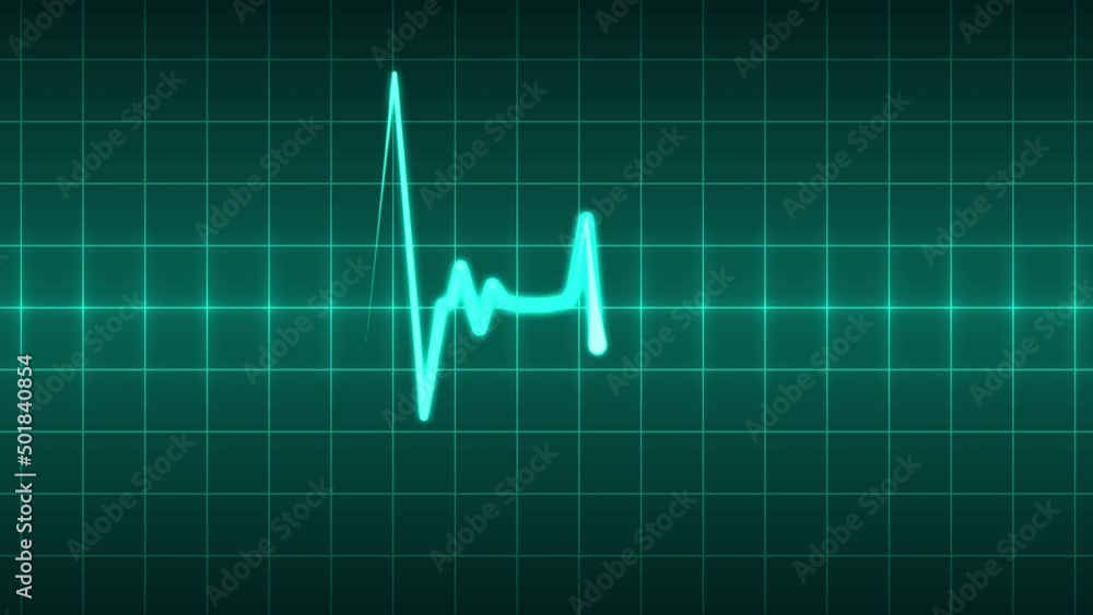 Healthy heartbeat animation. Pulse trace green line on dark green grid ...