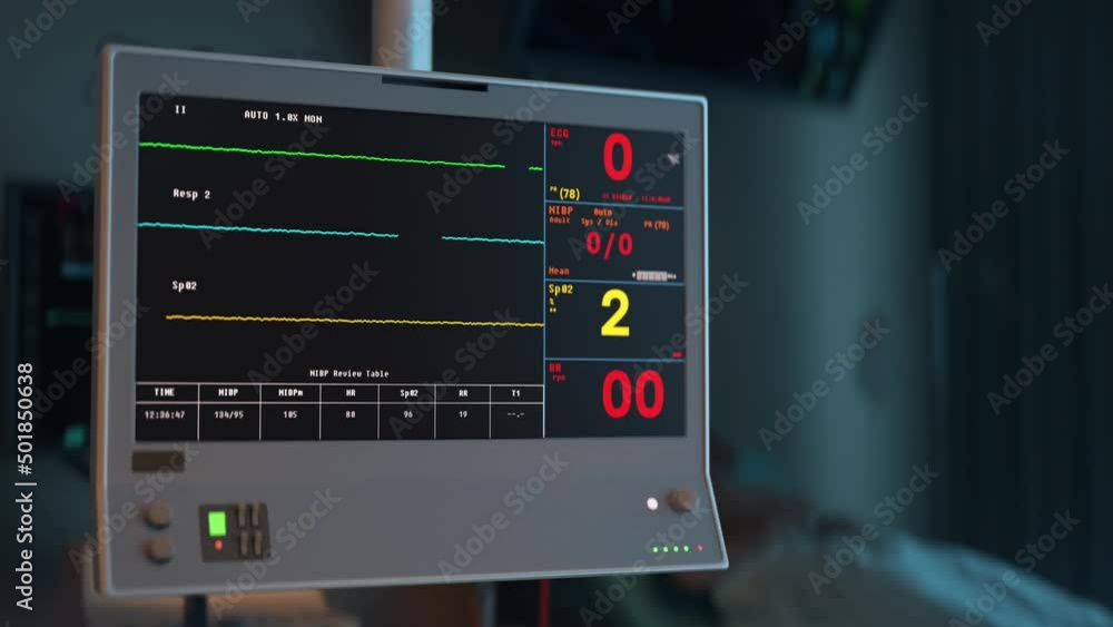 ECG Device Displays Dying Vital Signs Because Of Illness Progression ...