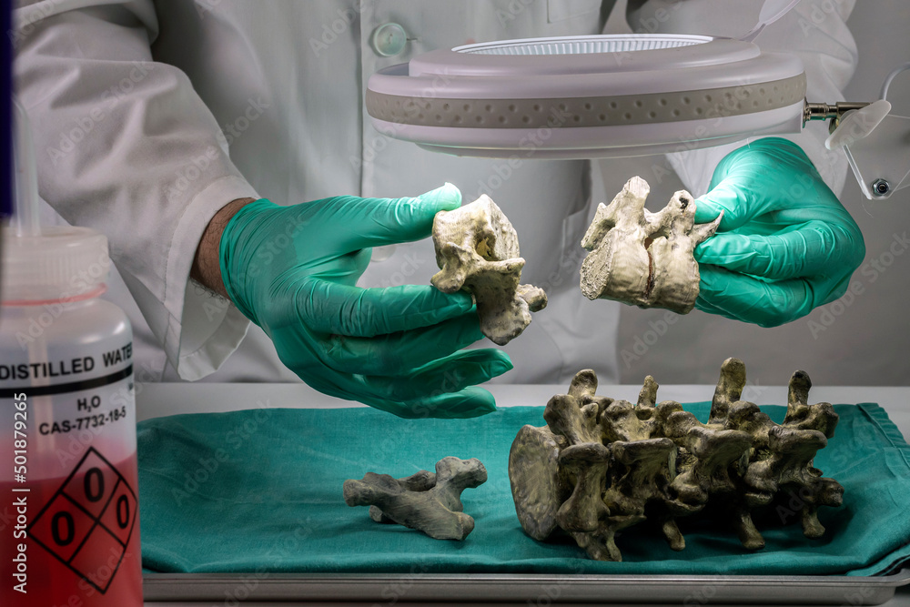 Forensic scientist comparing two human vertebrae of adult male homicide ...