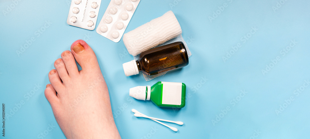 Problem of injured toenail, treatment in clinic. Diagnosis, treatment ...